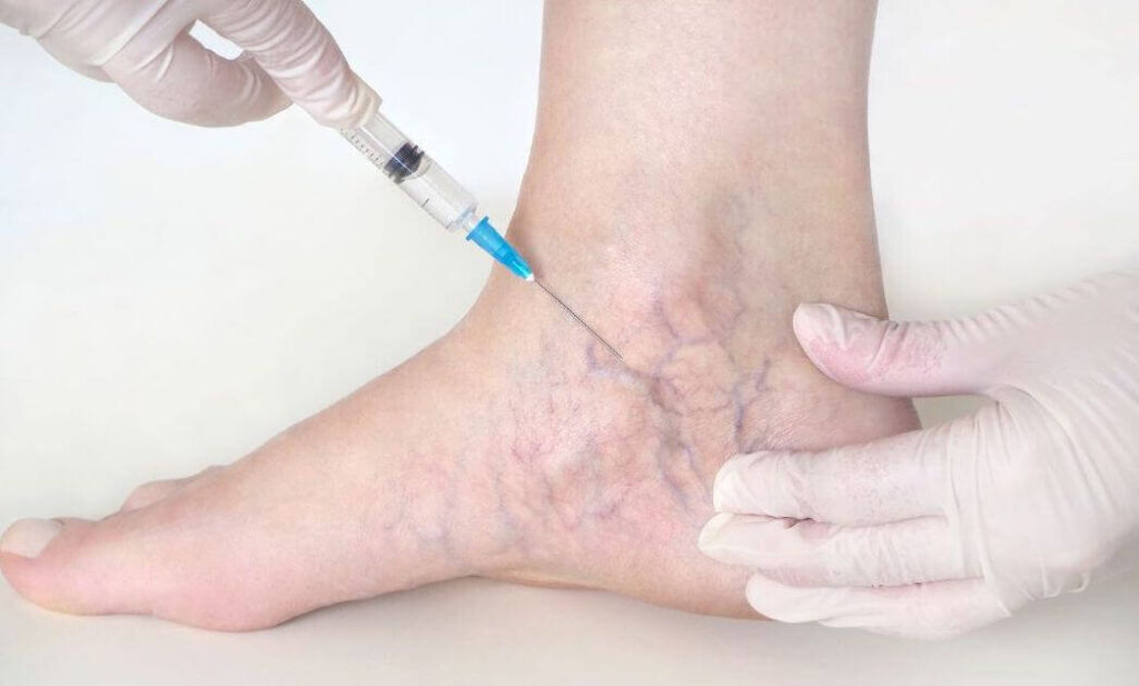 10 Things You Can Use Botox For That You Didn’t Know About – Revolve ...